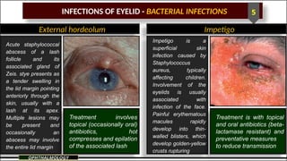 Infections of Eyelid Cornea Conjectiva and Uveitis.pptx