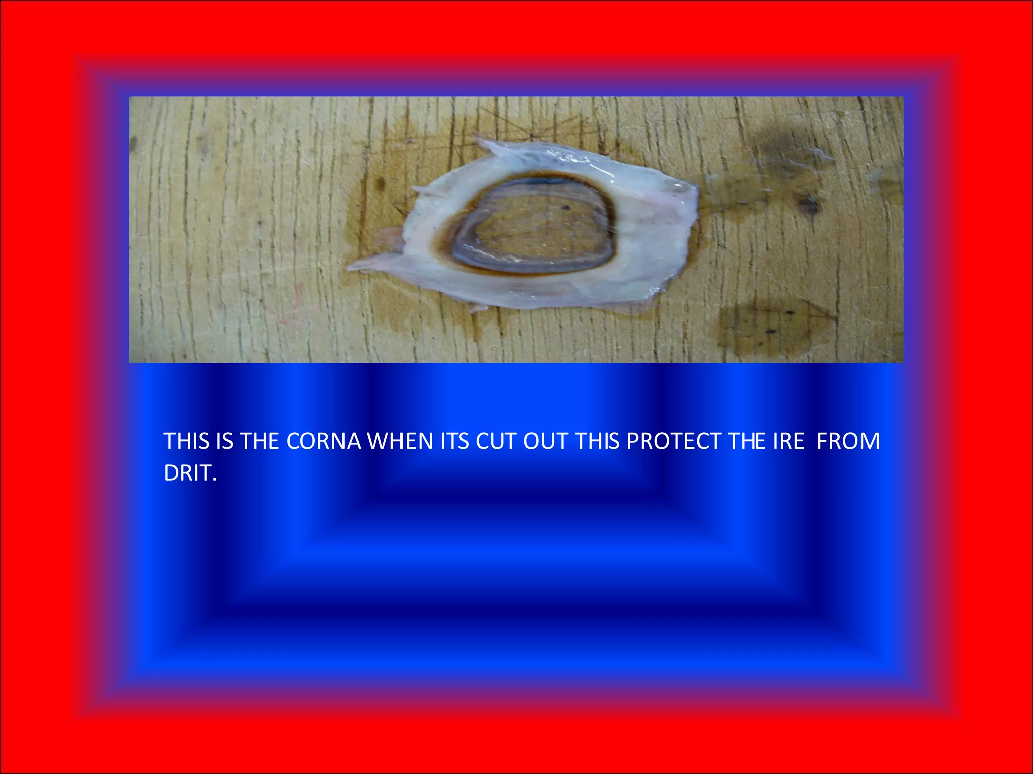 Eye Dissection | PPT | Eye and Vision Conditions | Diseases and Conditions