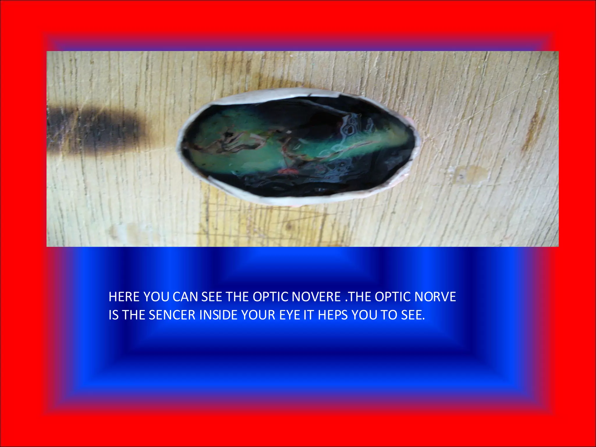 Eye Dissection | PPT | Eye and Vision Conditions | Diseases and Conditions