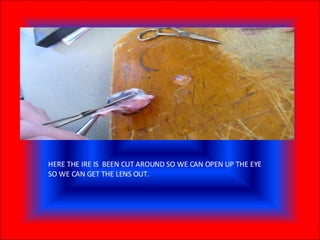 Eye Dissection | PPT | Eye and Vision Conditions | Diseases and Conditions