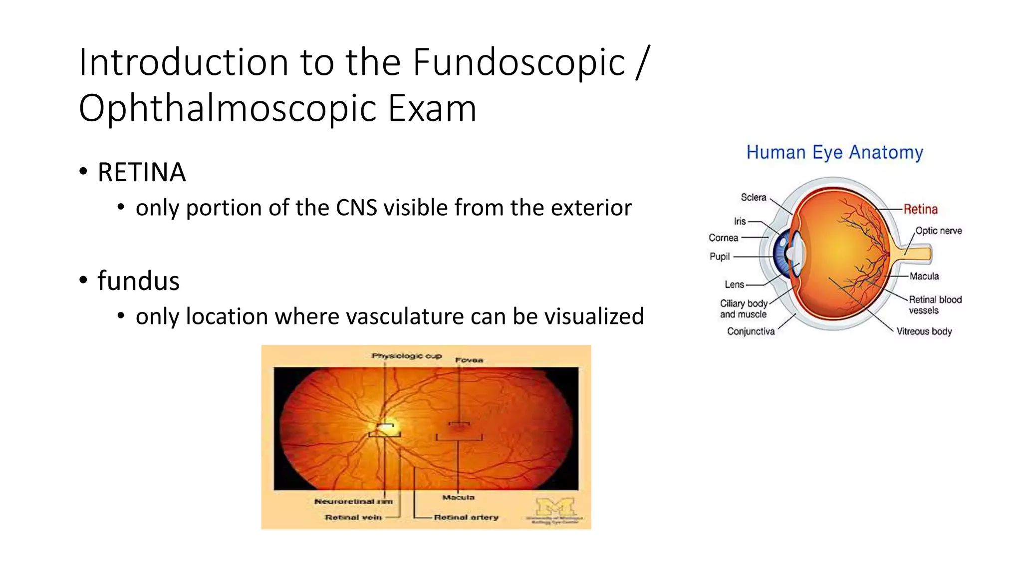 EYE -Fundoscopy PPT.pptx