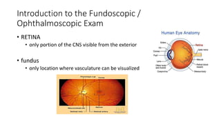 EYE -Fundoscopy PPT.pptx