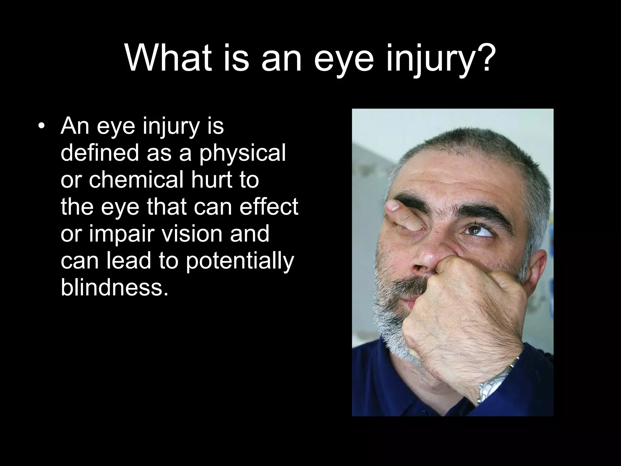 Eye Injuries | PPT