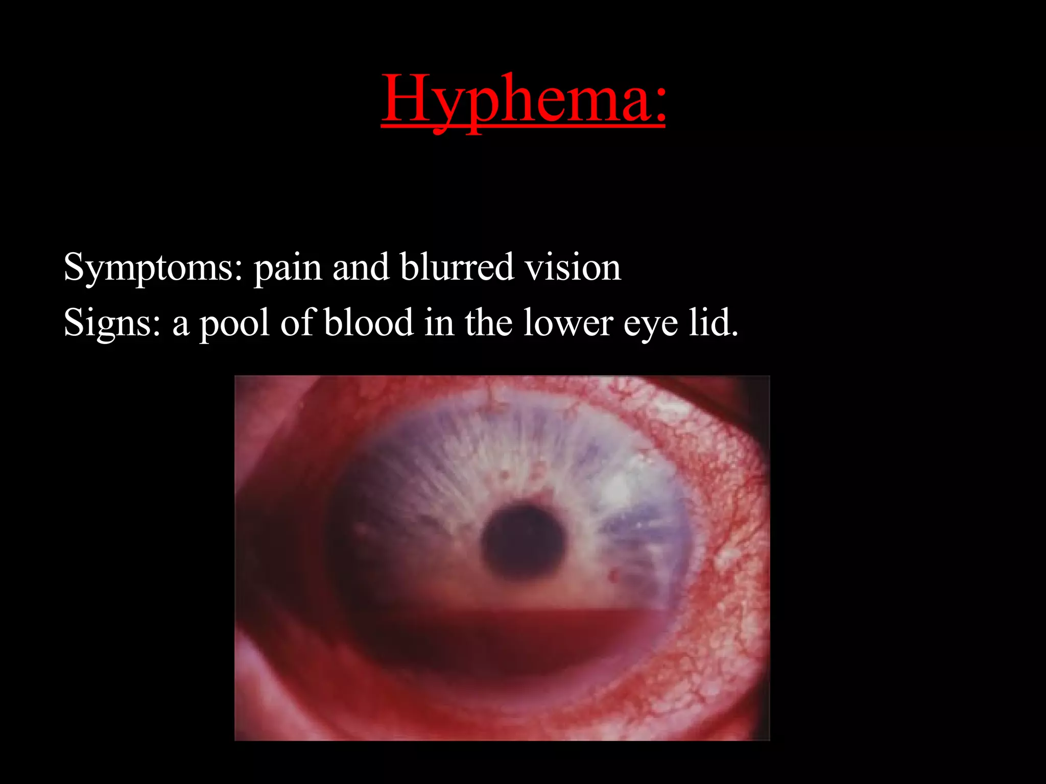 Eye Injuries | PPT