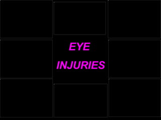 Eye Injuries | PPT