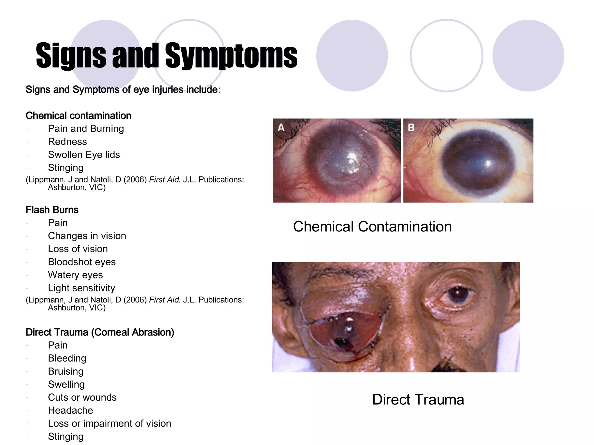Eye Injuries | PPT