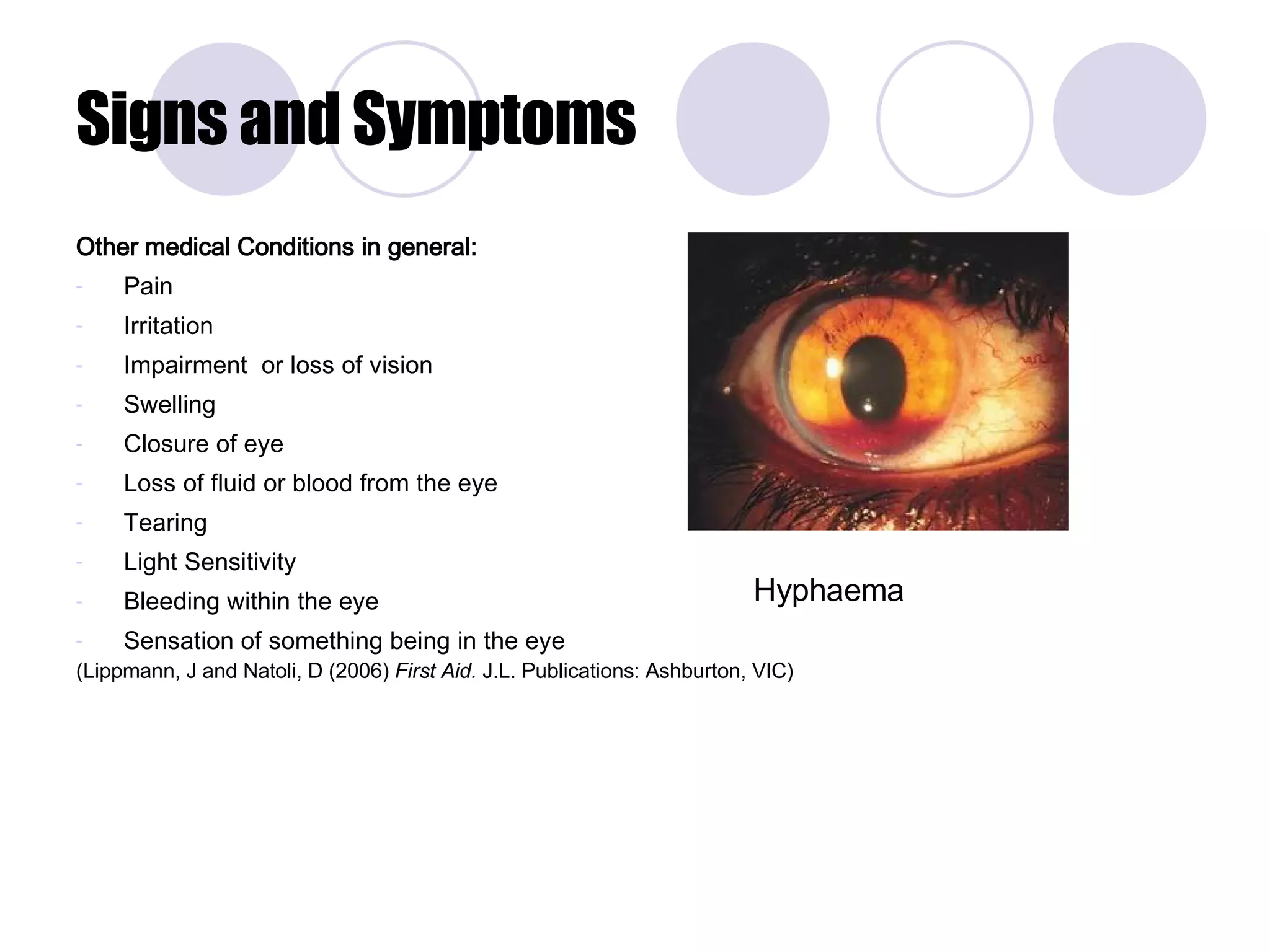Eye Injuries | PPT