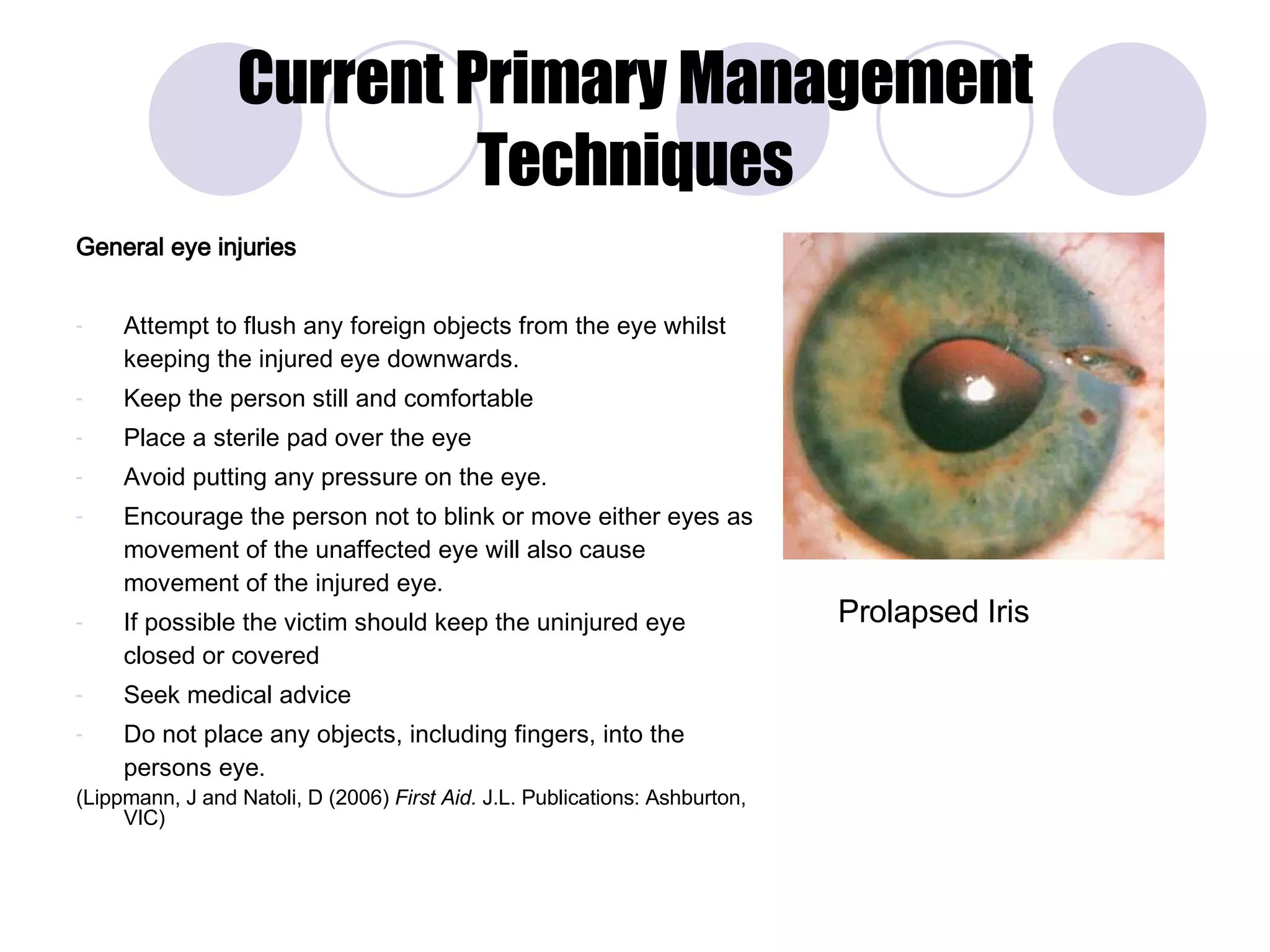 Eye Injuries | PPT