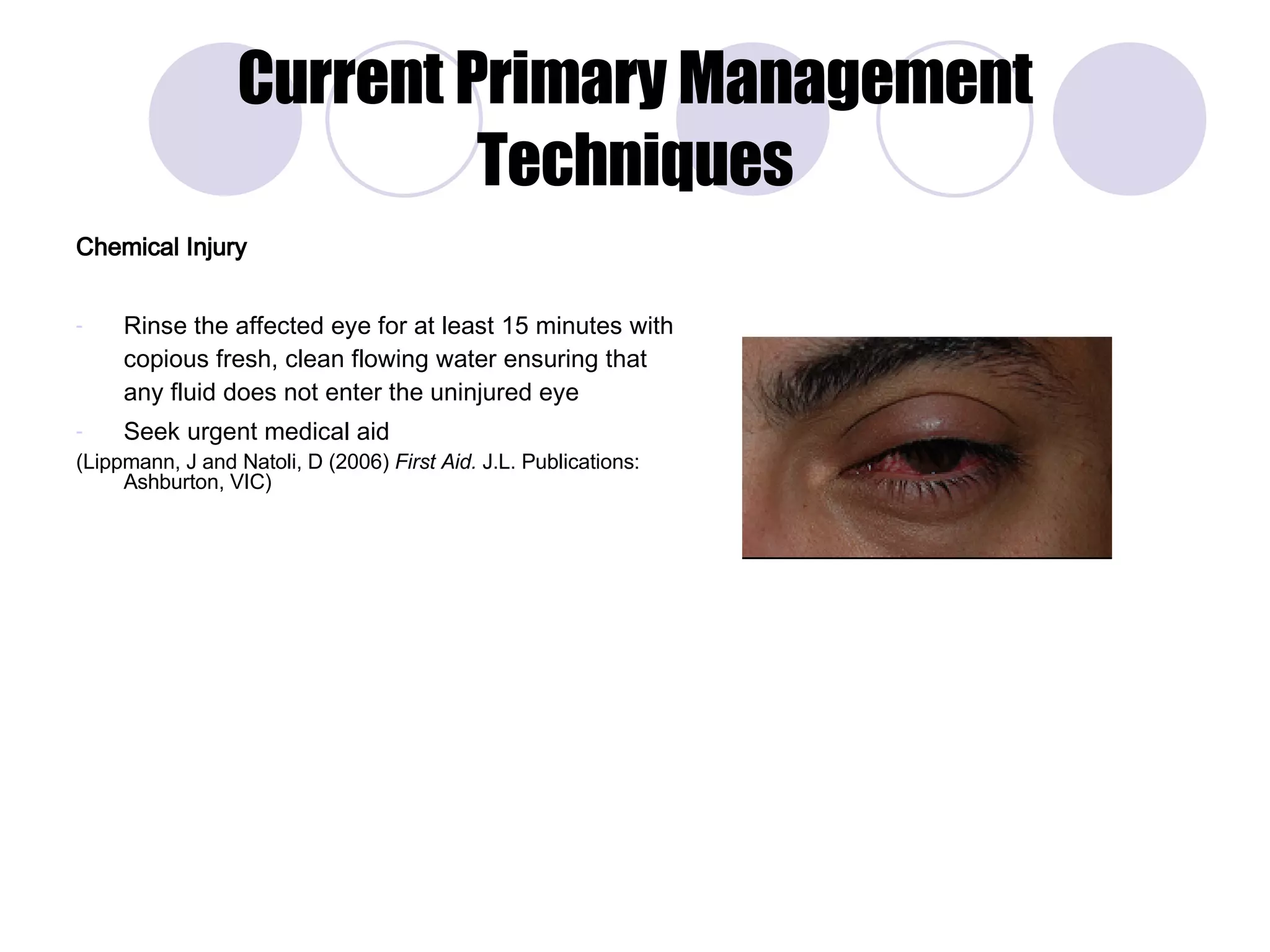 Eye Injuries | PPT