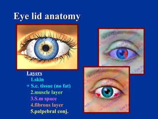 Eye Lid Dr.Ashraf | PPT