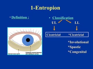 Eye Lid Dr.Ashraf | PPT