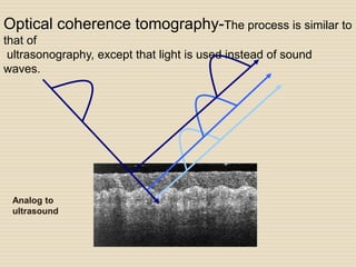 EYE-OCT.(OPTICAL COHERANCE TOMOGRAPHY) | PPT