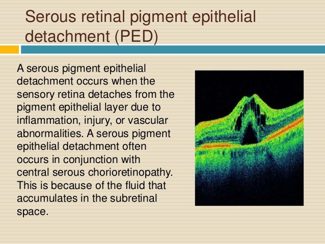 EYE-OCT.(OPTICAL COHERANCE TOMOGRAPHY)