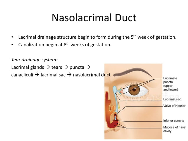 Right Nasolacrimal Duct Probing – SKRW