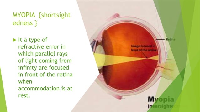reflective error | PPT
