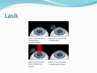 Eye anatomy | PPT