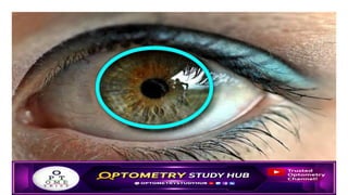 EYE 👁️ ANATOMY Optometry Notes (1).pdf