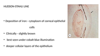 EYE AND AGING POWERPOINT PRESENTATION PPT | PPTX