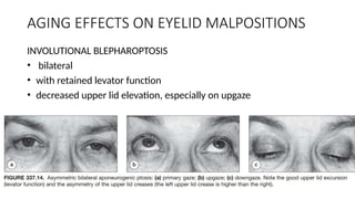 EYE AND AGING POWERPOINT PRESENTATION PPT | PPTX