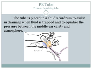 Eye and ear presentation | PPT