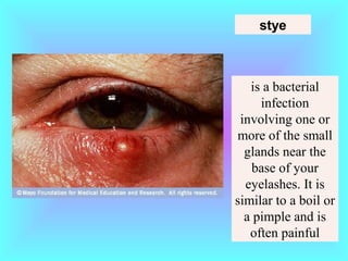 eyeandearassessment and its diagnosis and treatment | PDF