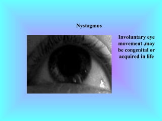 eyeandearassessment and its diagnosis and treatment | PDF