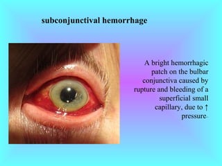 Eye and ear assessment | PPT