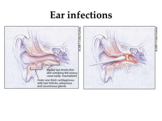 Eye and ear infections microbiology and medicine.ppt