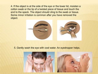 Eye and ear problems first aid | PPTX