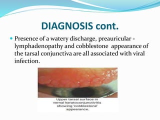 Refractive error and conjuctivitis for nursing | PPTX