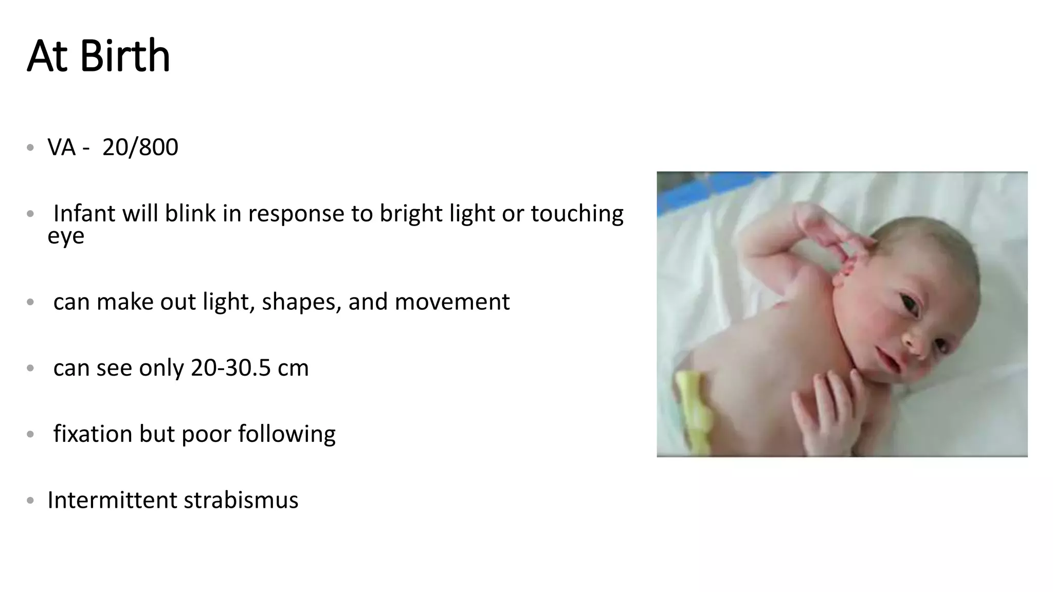 Eye and vision at birth and childhood | PPTX