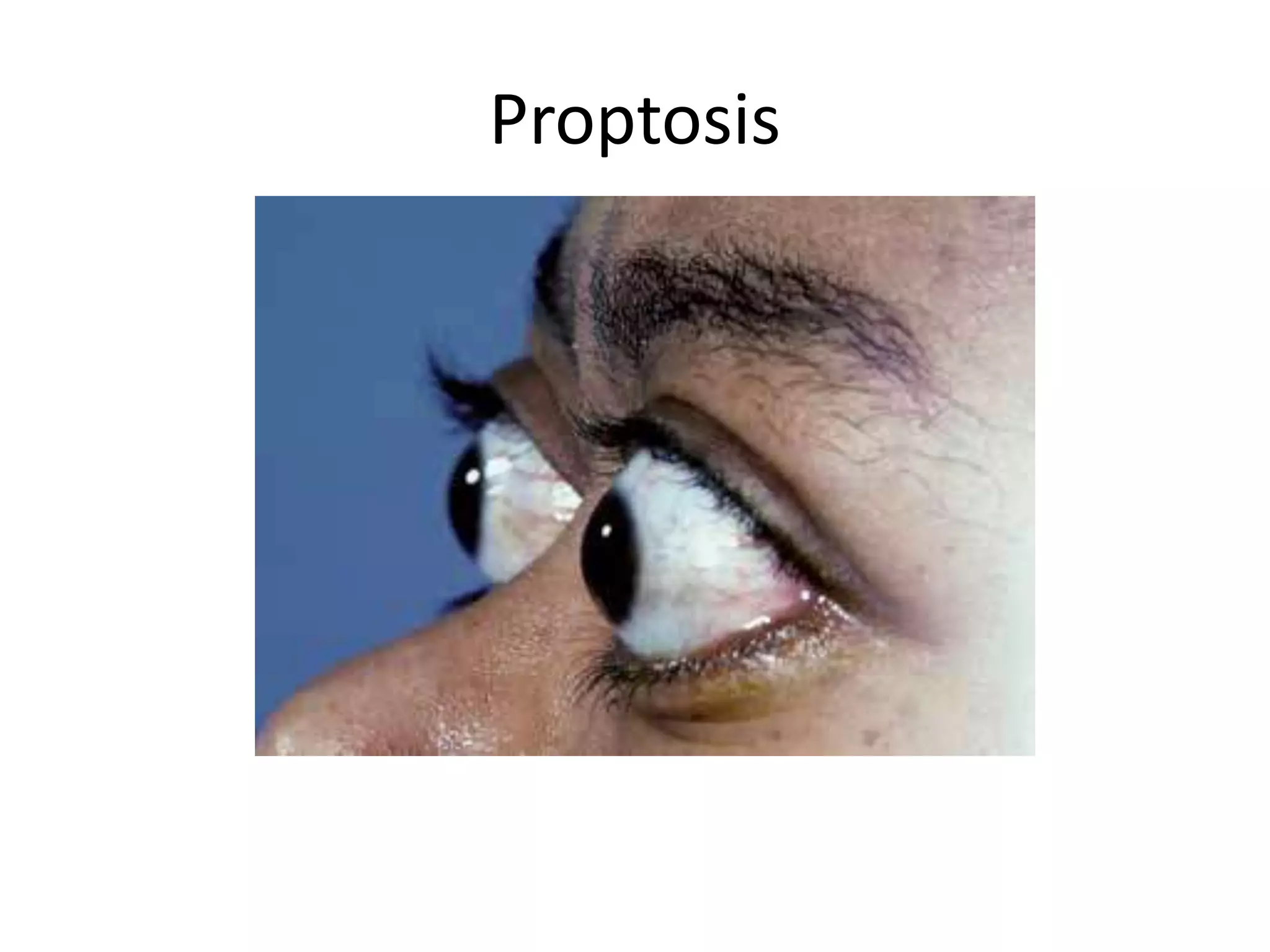 Eye an indicator of systemic diseases - General physical examination | PPT