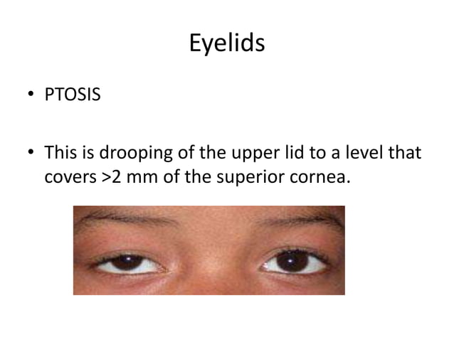 Eye an indicator of systemic diseases - General physical examination | PPT