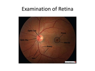Eye an indicator of systemic diseases - General physical examination | PPTX