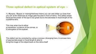 Eye as an optical system. | PDF