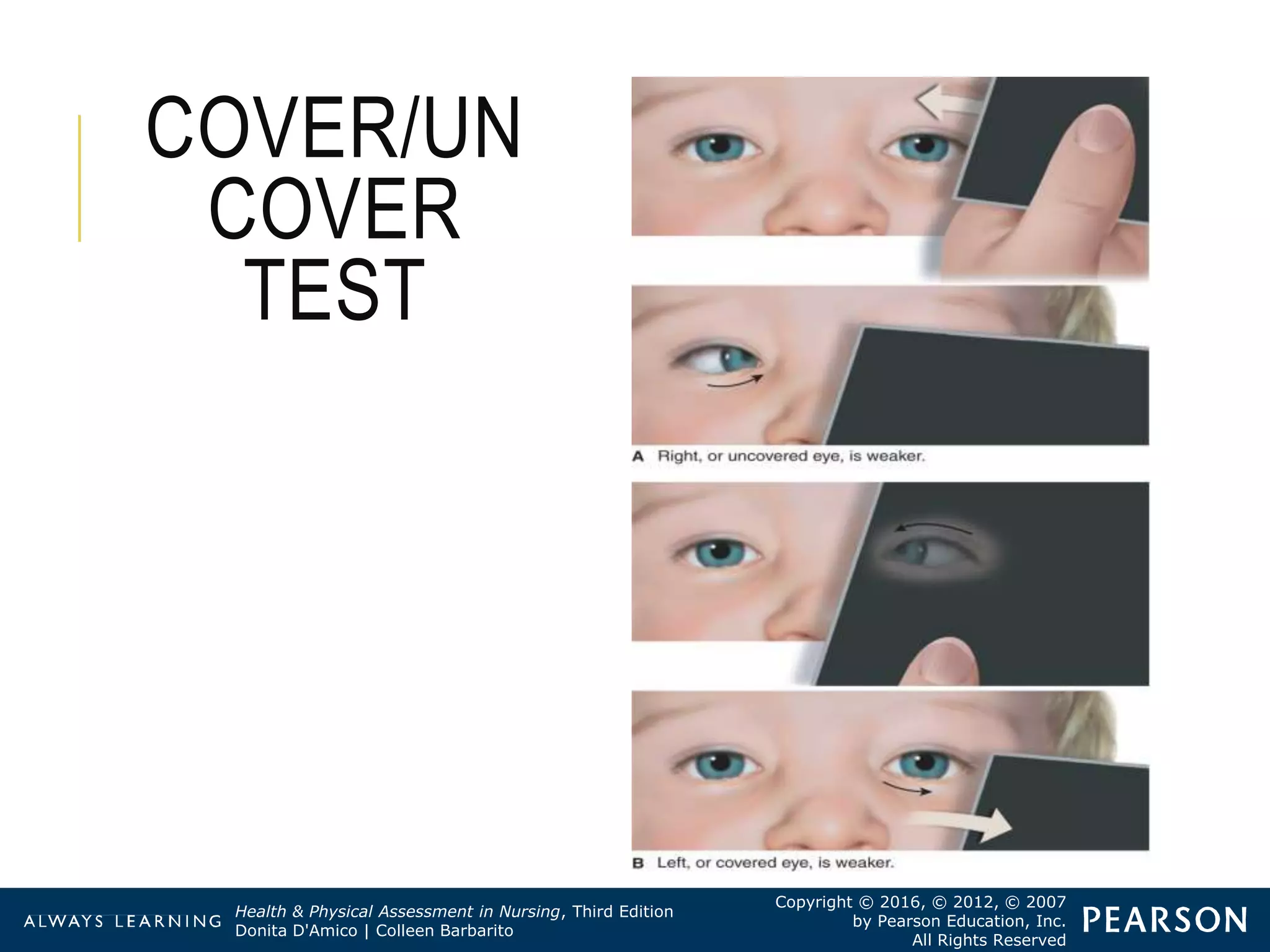 EYE ASSESSMENT.ppt