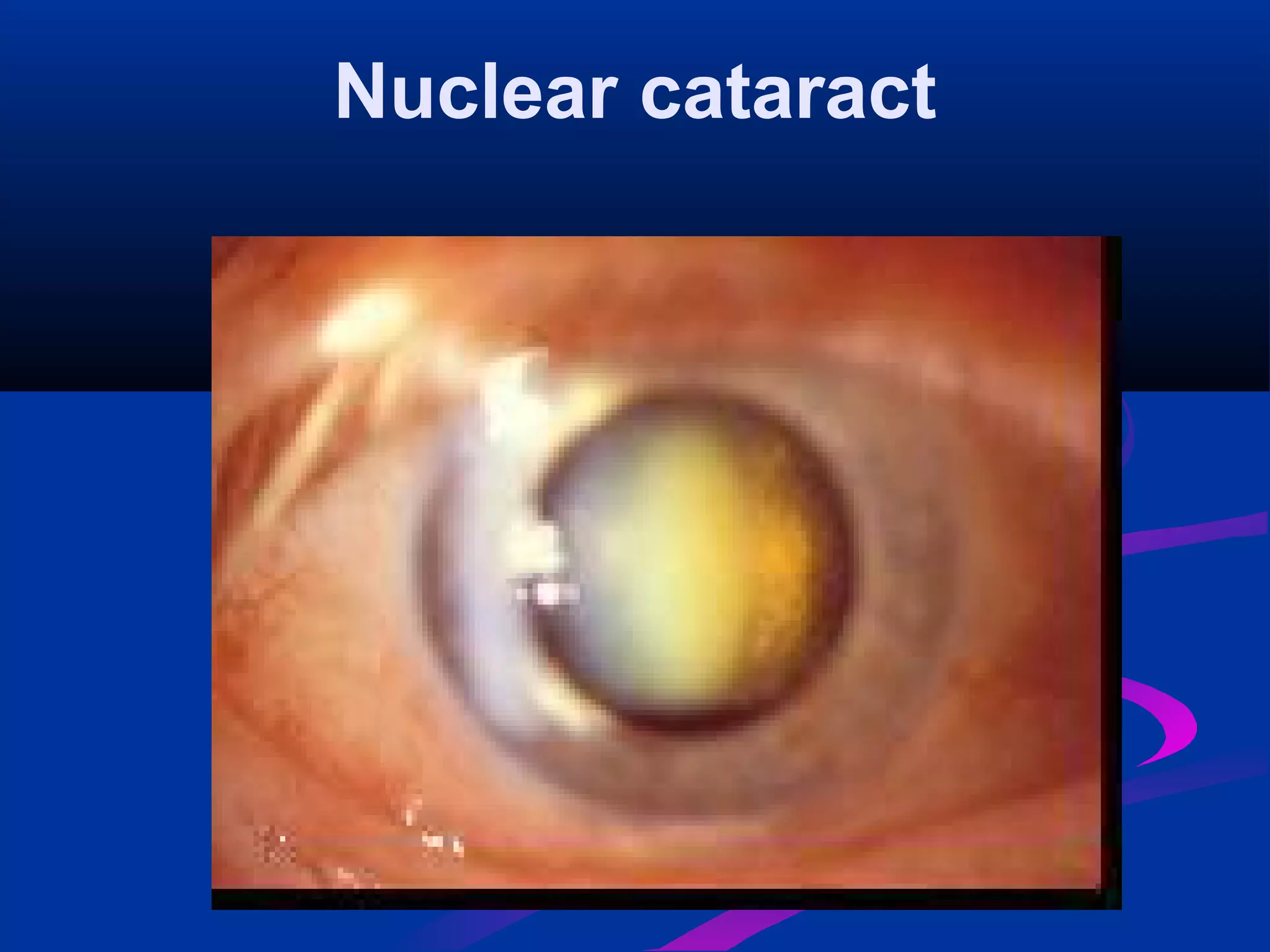 Eye atlas of disease (ayemon) | PPT