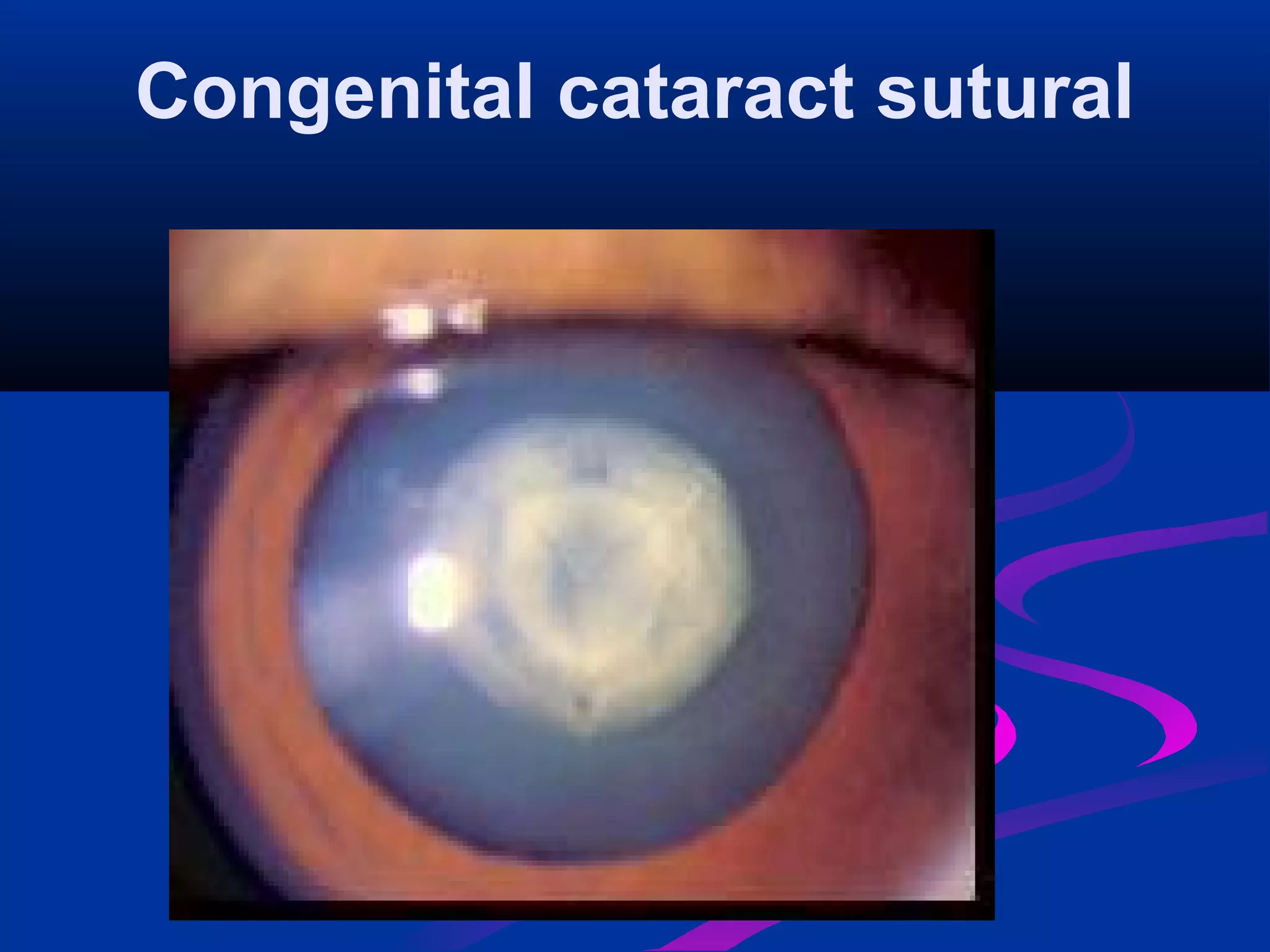 Eye atlas of disease (ayemon) | PPT