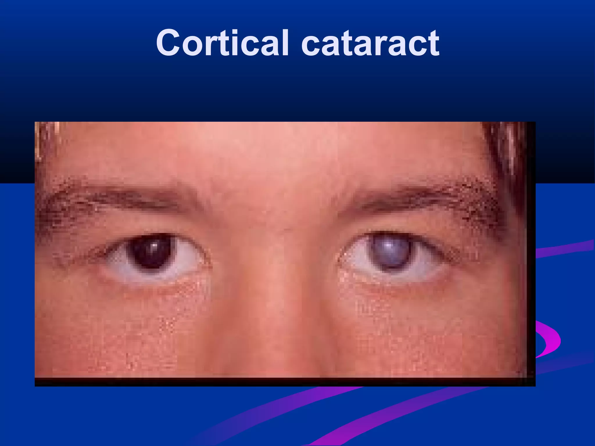 Eye atlas of disease (ayemon) | PPT