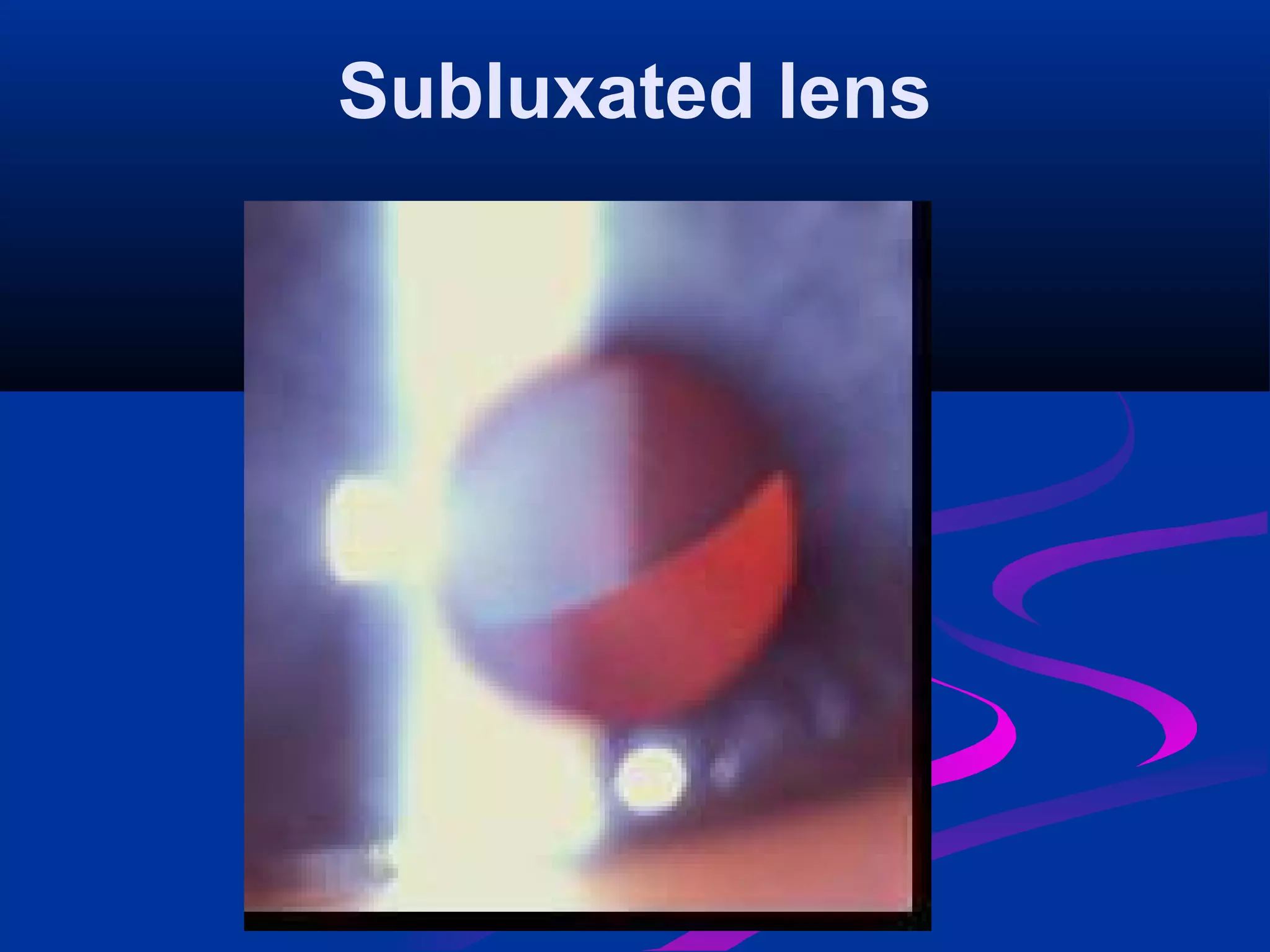 Eye atlas of disease (ayemon) | PPT