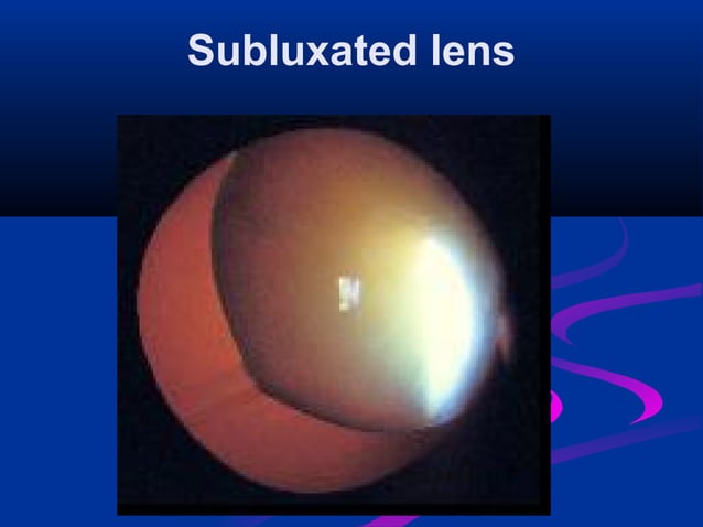 Eye atlas of disease (ayemon) | PPT