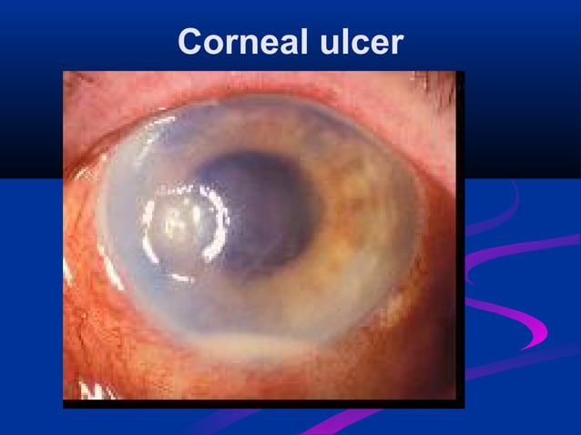 Eye atlas of disease (ayemon) | PPT