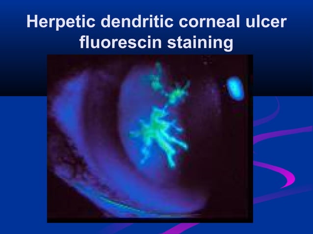 Eye atlas of disease (ayemon) | PPT