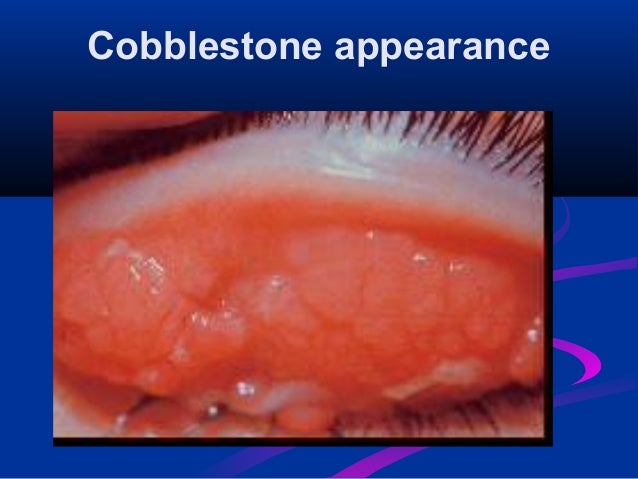 Eye atlas of disease (ayemon)