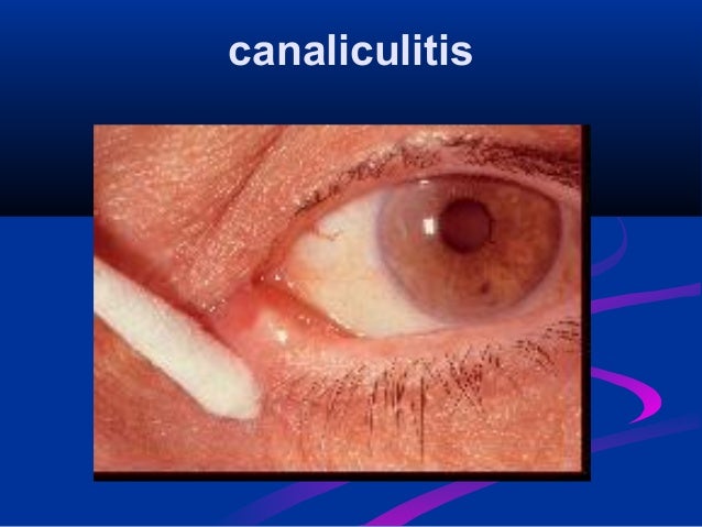 Eye atlas of disease (ayemon)