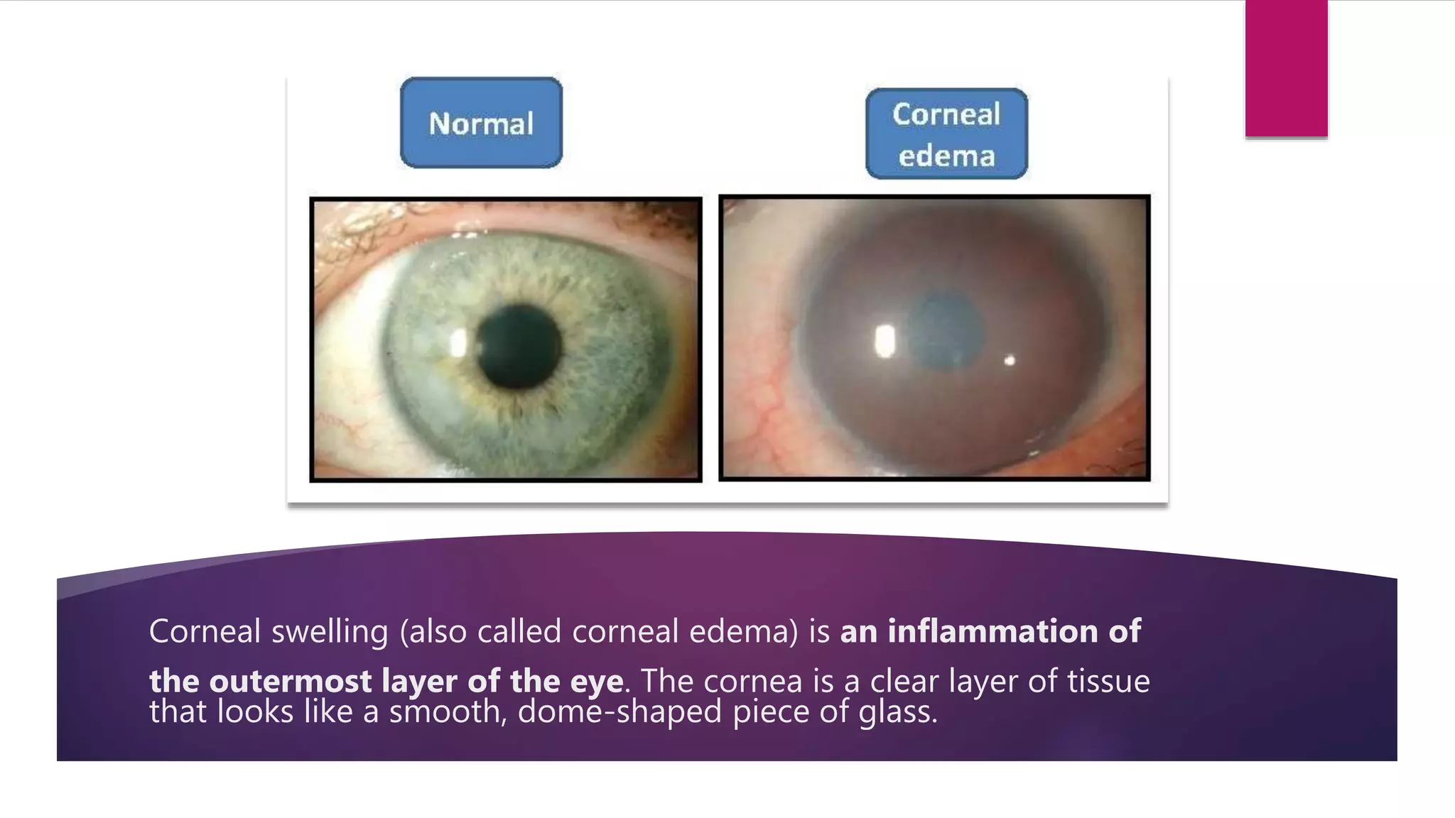 Eye Bandaging Nursing Procedure | PPTX