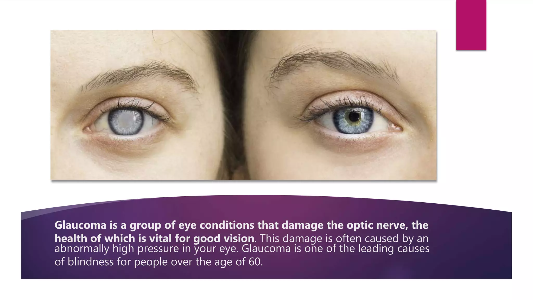 Eye Bandaging Nursing Procedure | PPTX