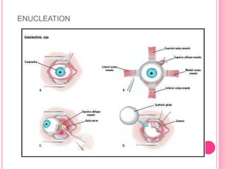 Eye Bank Eye Ball Logo