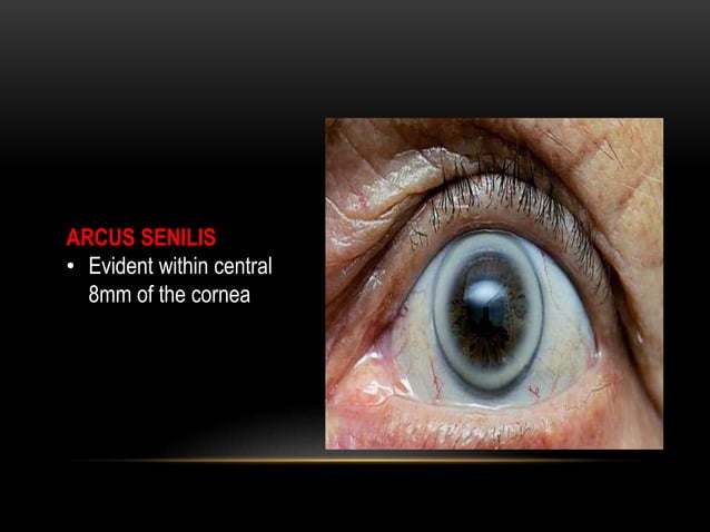 Eye banking | PPTX | Eye and Vision Conditions | Diseases and Conditions