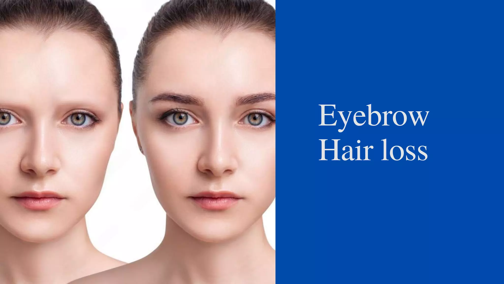 EYEBROW HAIR LOSS & TRANSPLANT.pptx